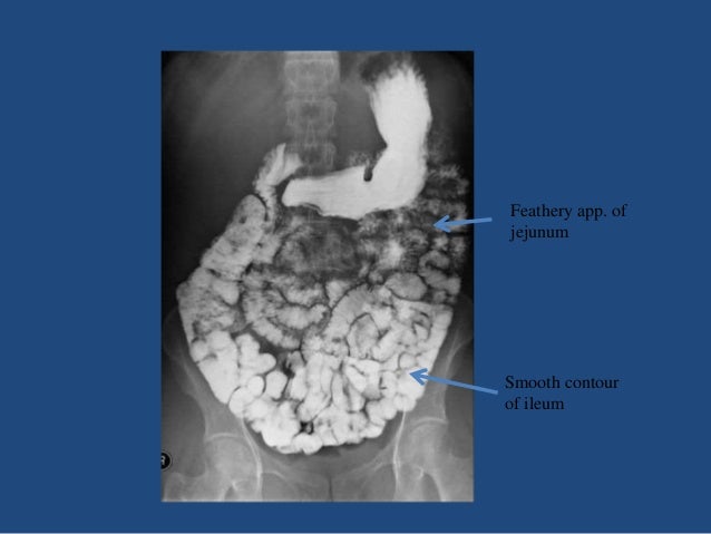 Flouroscopic procedures
