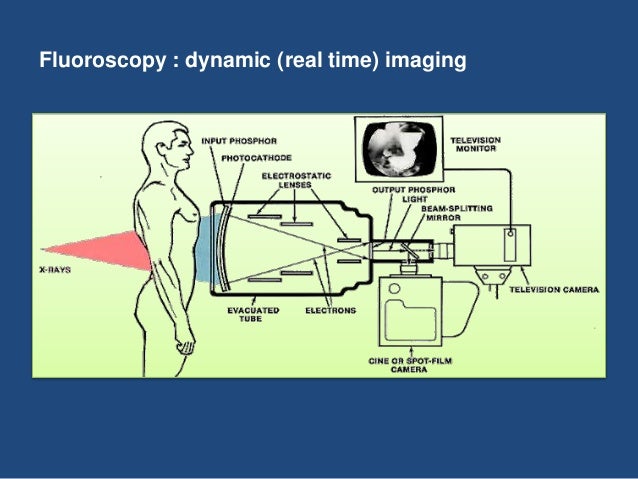 Flouroscopic procedures