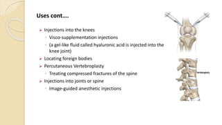 Flouroscopy JP.pptx