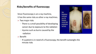 Flouroscopy JP.pptx
