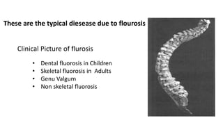 Flourosis in andhra pradesh | PPTX
