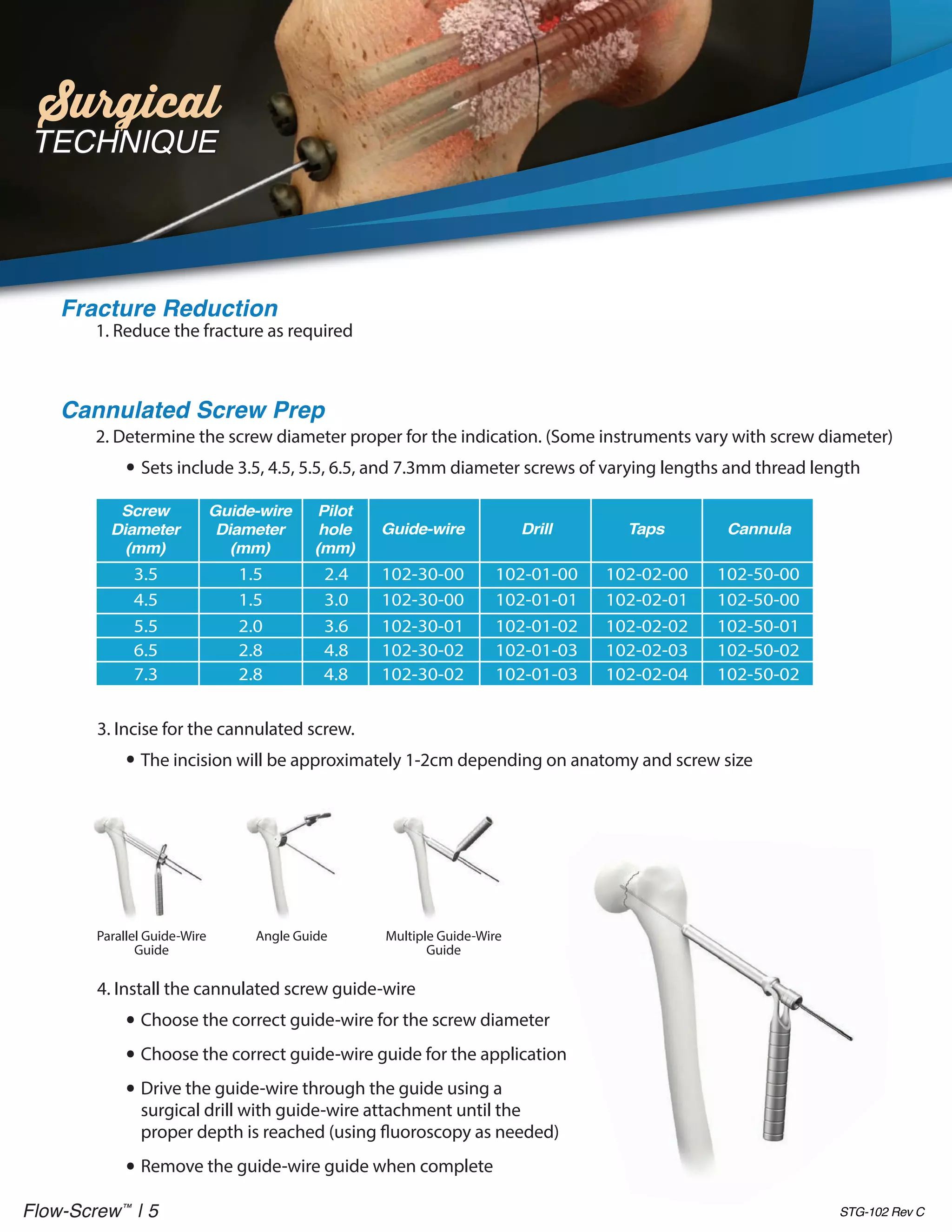 Flow-FX Flow Screw ~ Surgical Technique Guide | PDF