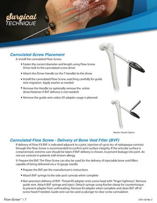 Flow-FX Flow Screw ~ Surgical Technique Guide | PDF
