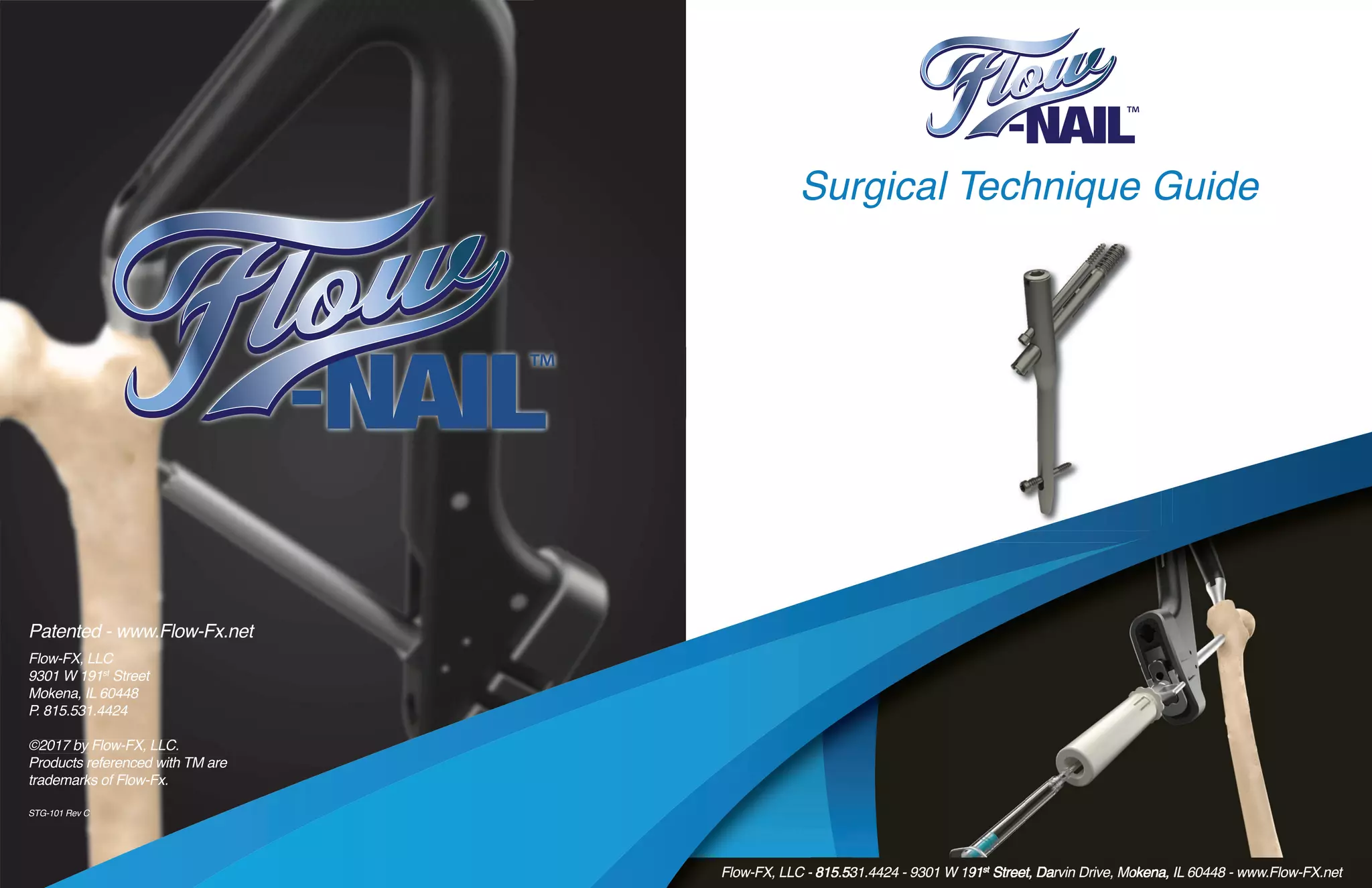 Flow-FX ~ Flow Nail Surgical Technique Guide | PPT