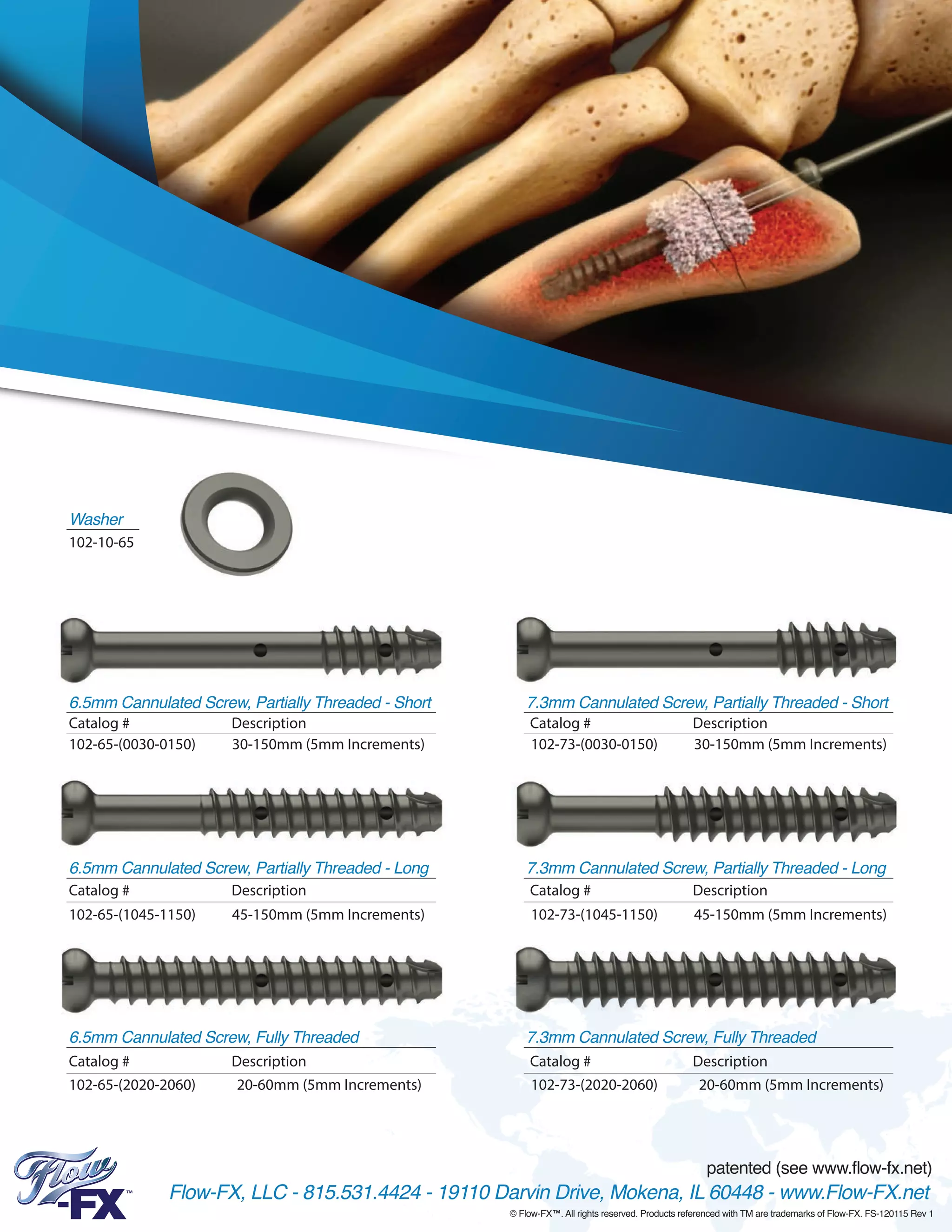 FlowFX: Flow Screw ~ Product Sheet | PDF