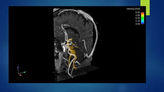 4D FLOW MRI | PPTX
