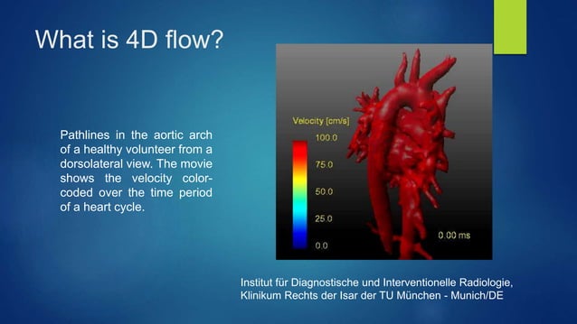 4D FLOW MRI | PPTX | Heart and Cardiovascular Diseases | Diseases and ...