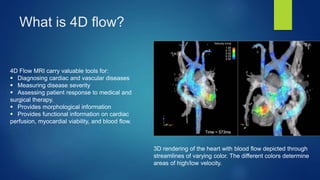 4D FLOW MRI | PPTX