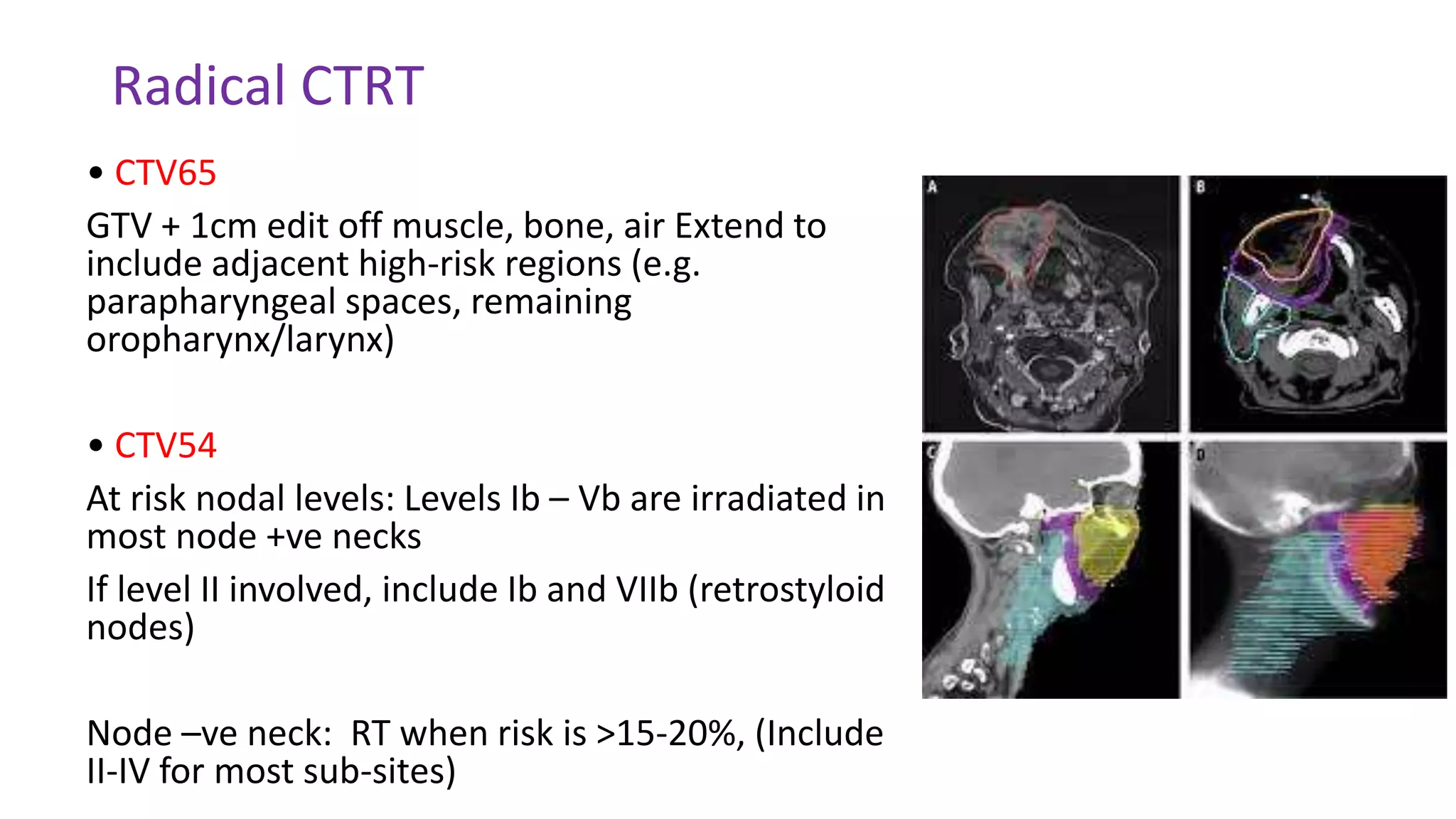 Flowchart of management in head and neck cancer | PPTX