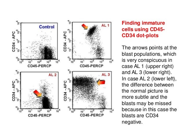 Normal And Abnormal Procyte Dx Dot Plots A Is A Normal