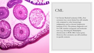 Flow Cytometryand its role in diagnosing acute leukemia.pptx