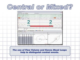 Flow volume loop quick loop guide | PPT