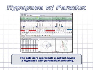 Flow volume loop quick loop guide | PPT