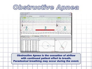 Flow volume loop quick loop guide | PPT