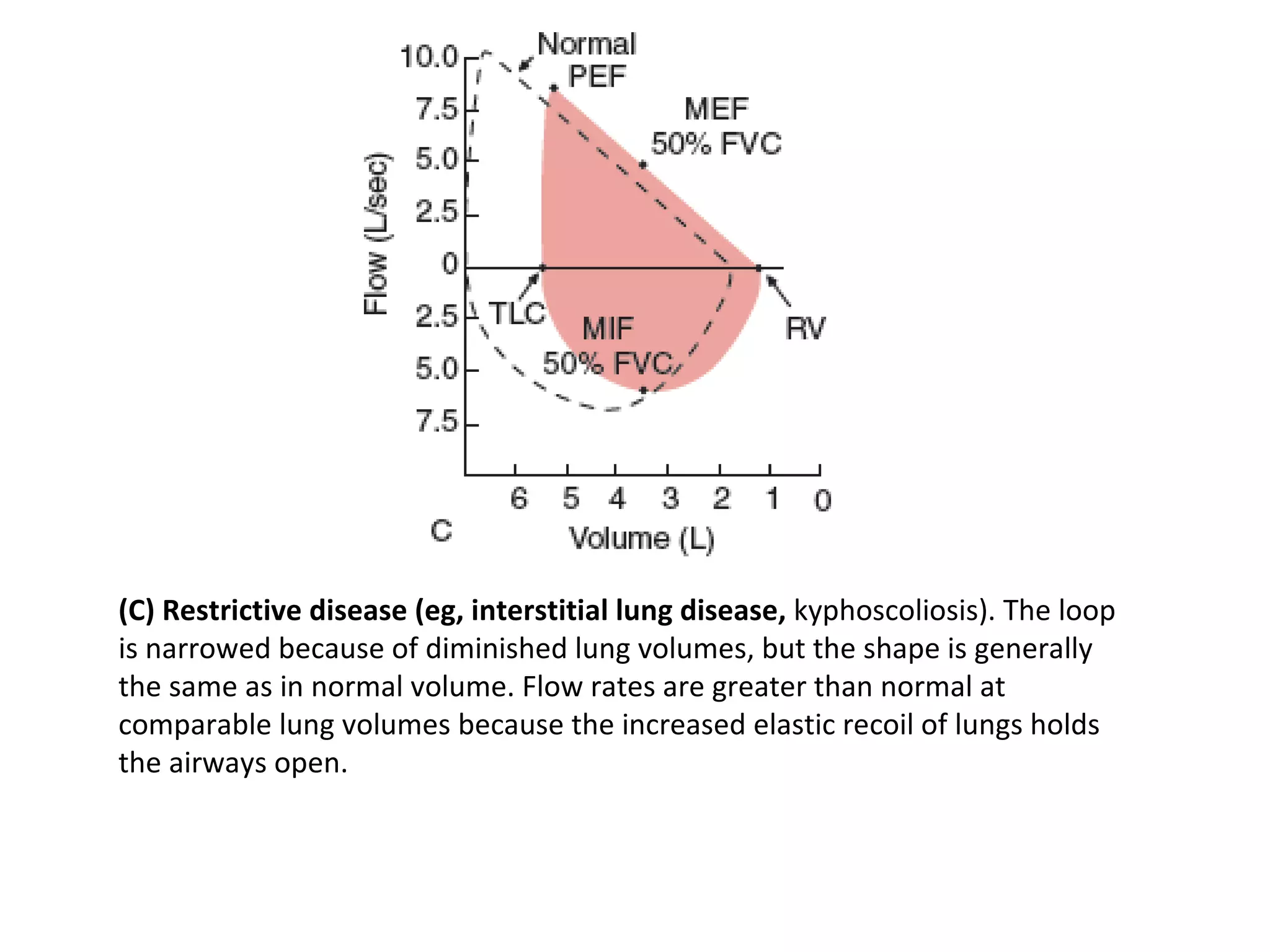 Flow volume loop | PPT