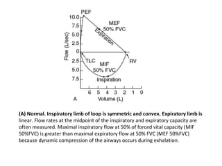 Tracheomalacia Flow Volume Loop