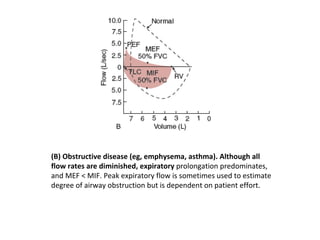 Tracheomalacia Flow Volume Loop