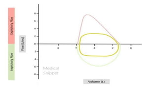 Flow Volume Loop Presentation.pptx