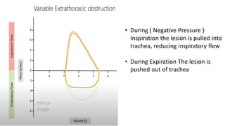 Flow Volume Loop Presentation.pptx