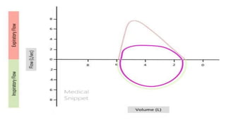 Flow Volume Loop Presentation.pptx