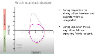 Flow Volume Loop Presentation.pptx