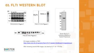 Learn FLT1/VEGFR1 in 3 minutes | Fms-related tyrosine kinase 1 | PPTX ...
