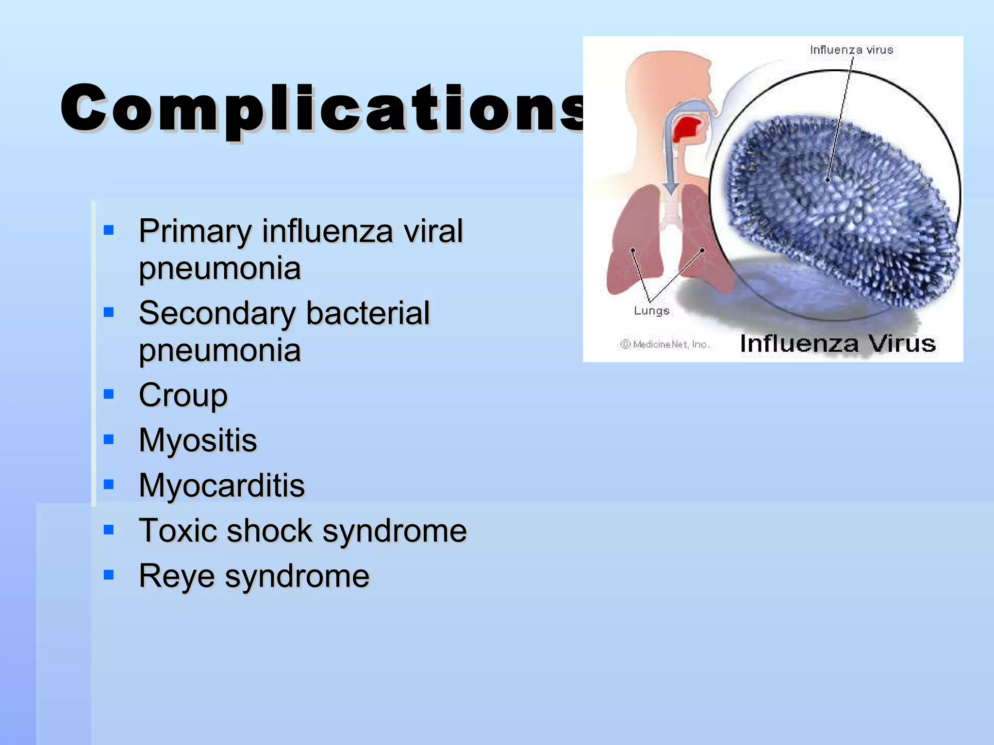 Influenza | PPT