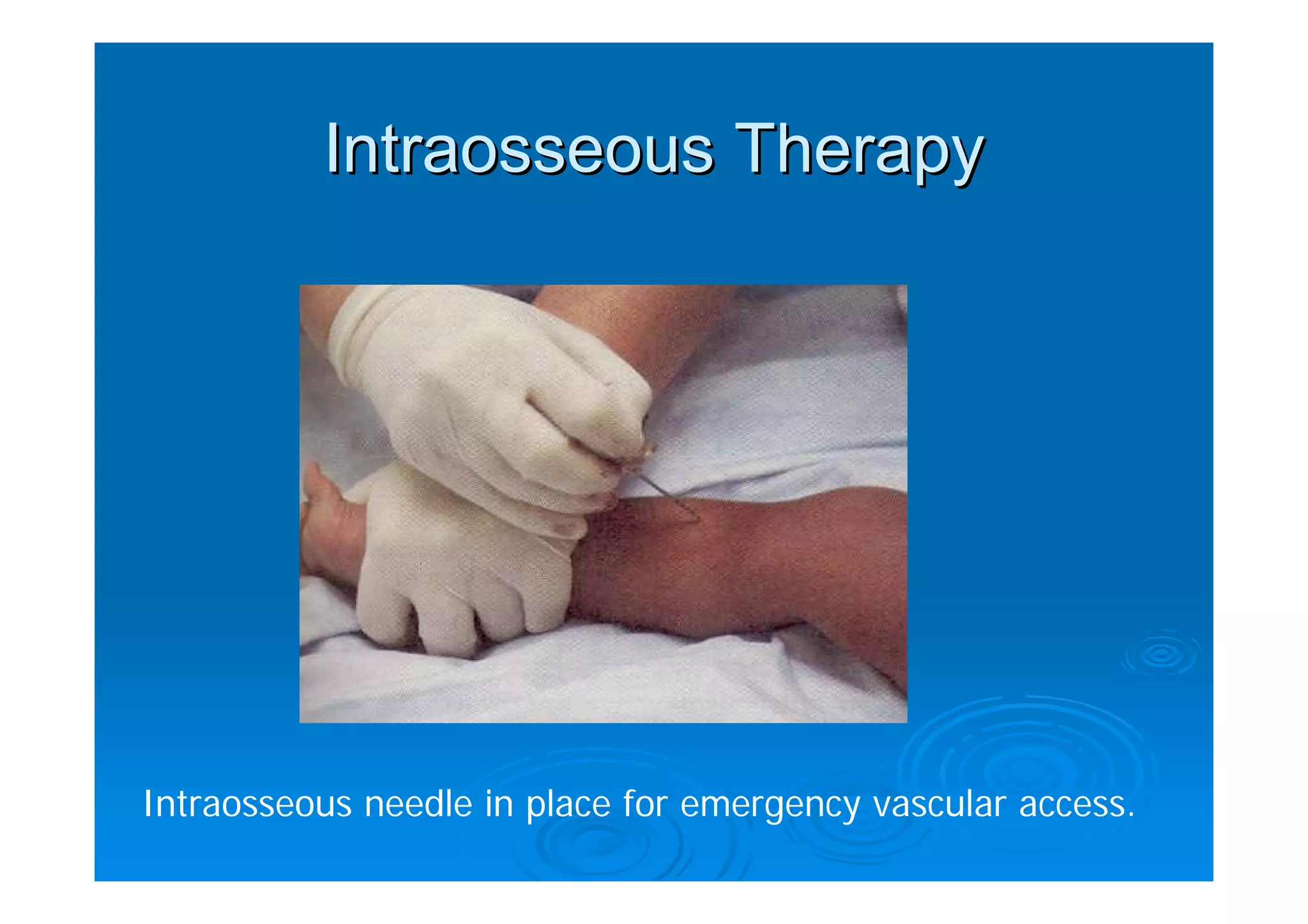 Fluids and Electrolytes in Infants and Children | PDF