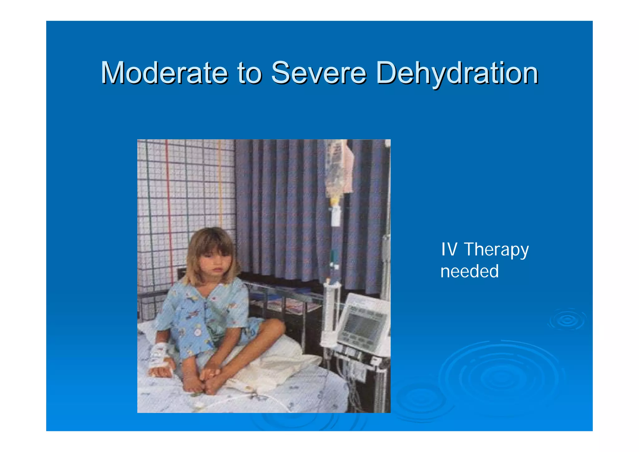 Fluids and Electrolytes in Infants and Children | PDF