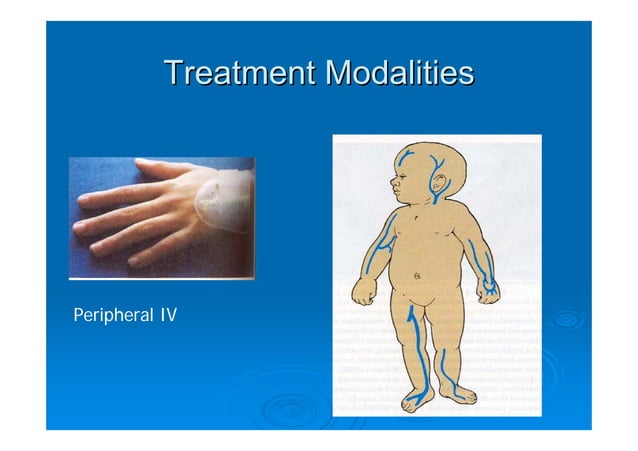 Fluids and Electrolytes in Infants and Children | PDF | Heart and ...