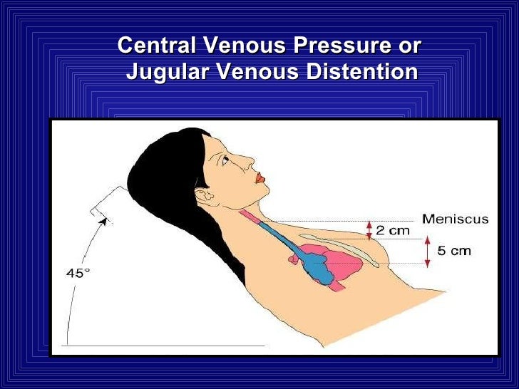 Fluid And Electrolytes1