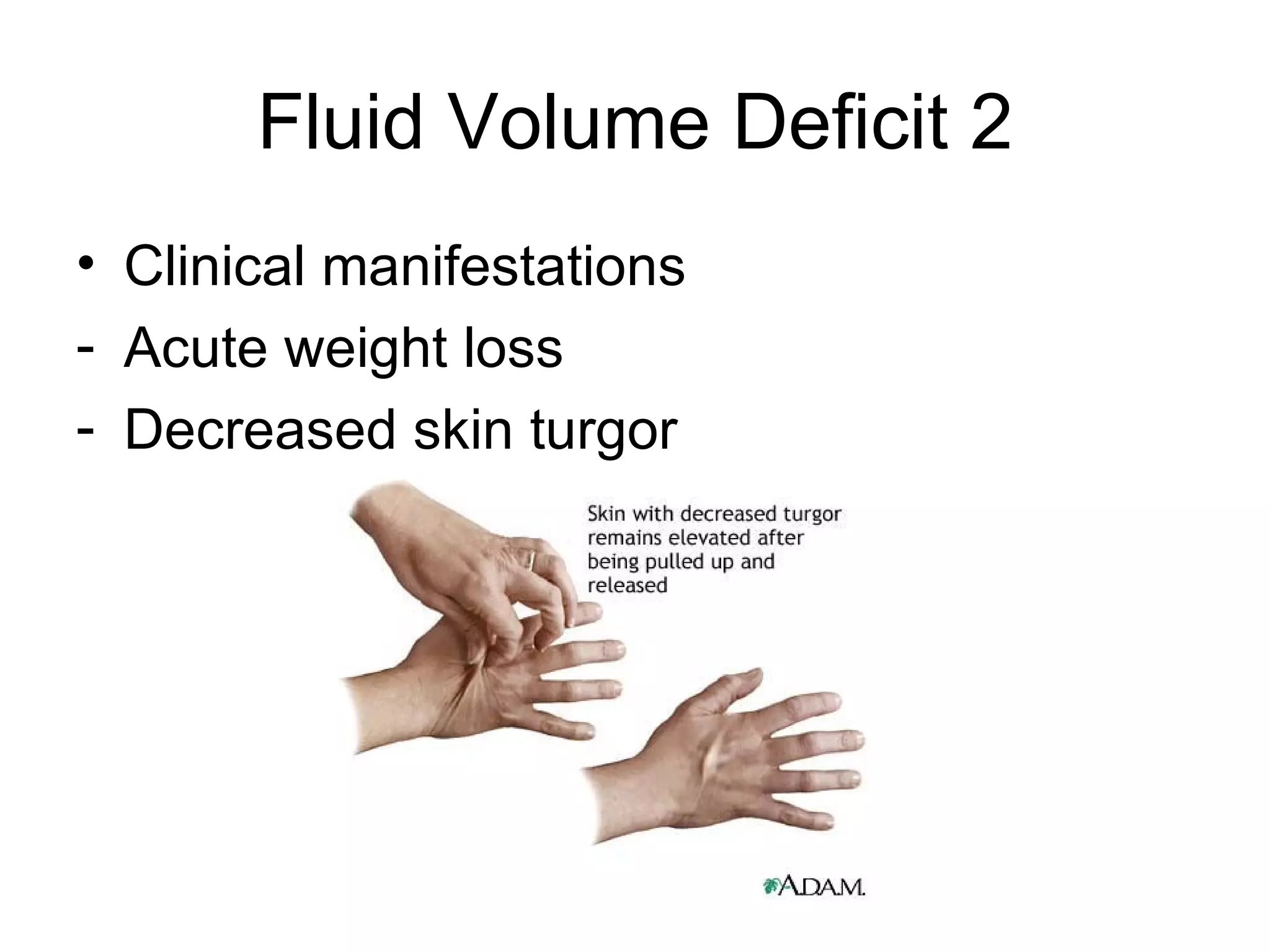 Fluid and electrolytes, balance and disturbances (1) | PPT