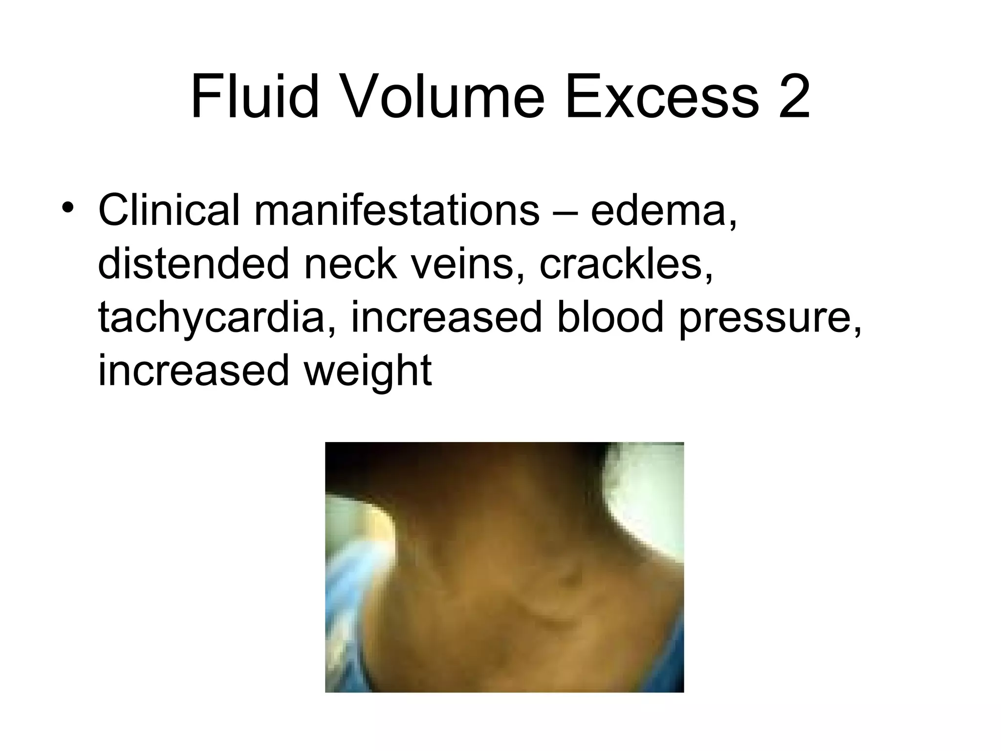 Fluid and electrolytes, balance and disturbances (1) | PPT