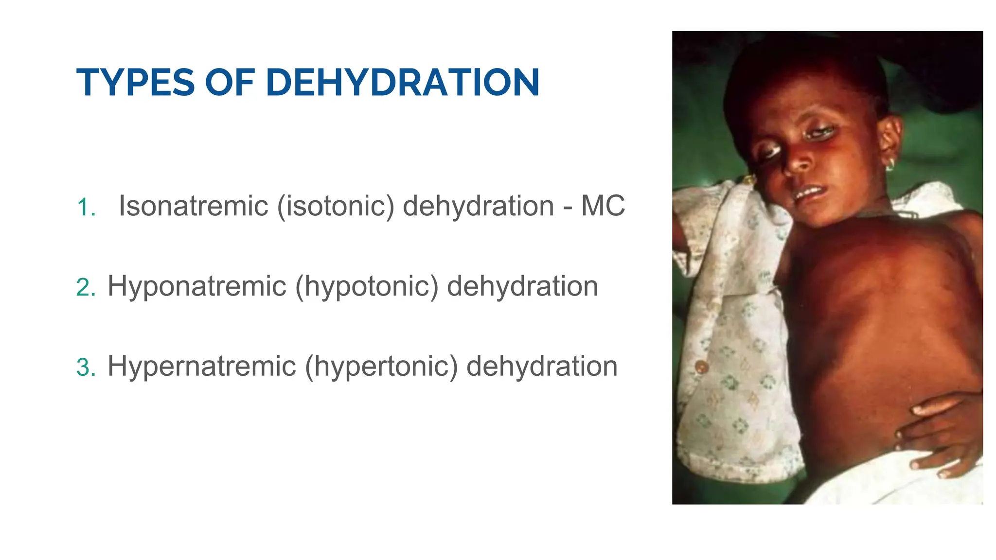 Fluid and Electrolyte Therapy in paediatrics | PPTX