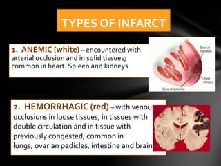 Fluid and Hemodynamic Derrangements | PPTX