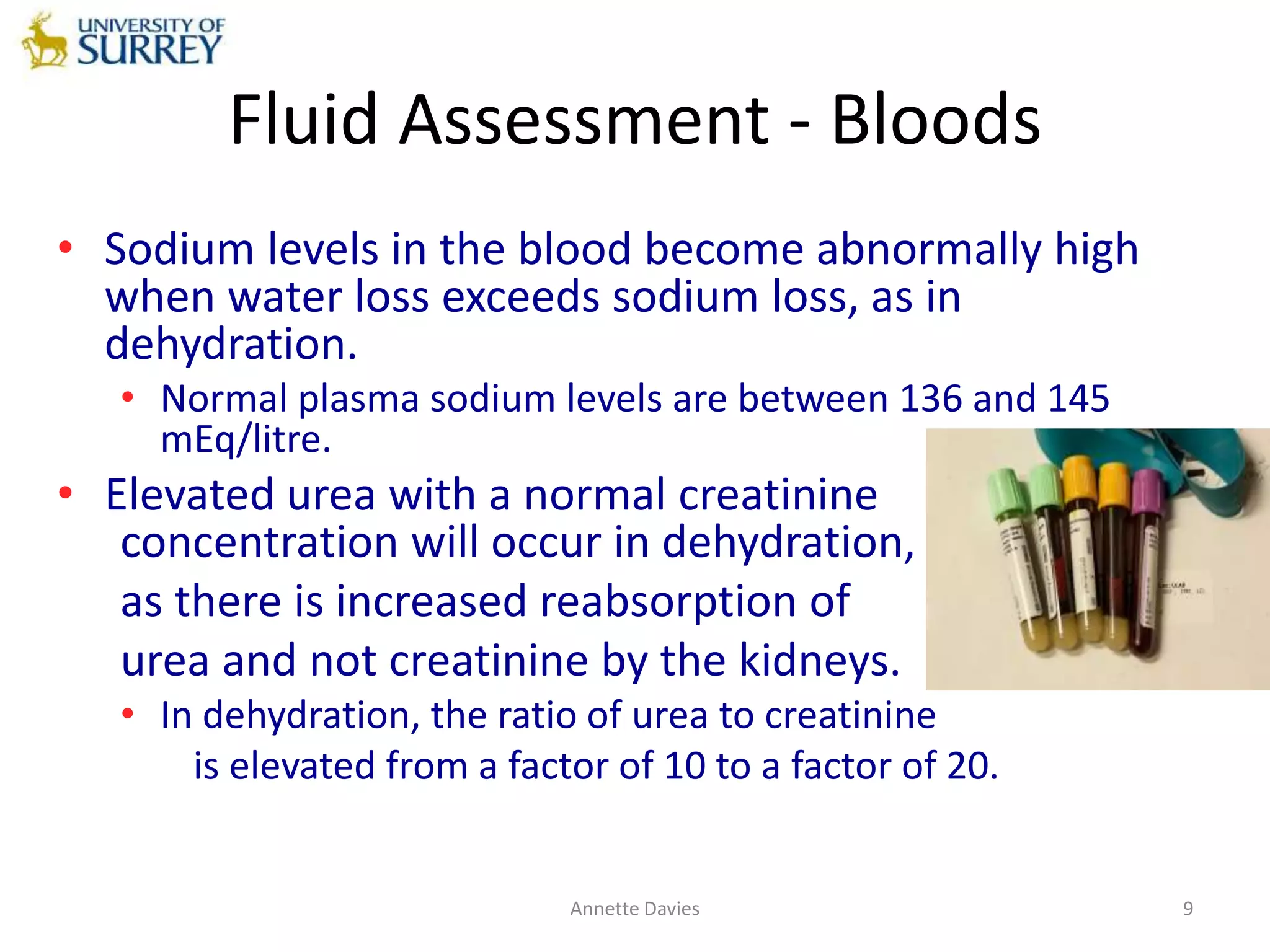 Fluid assessment | PPTX