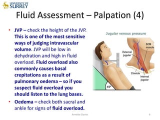 Fluid assessment | PPTX