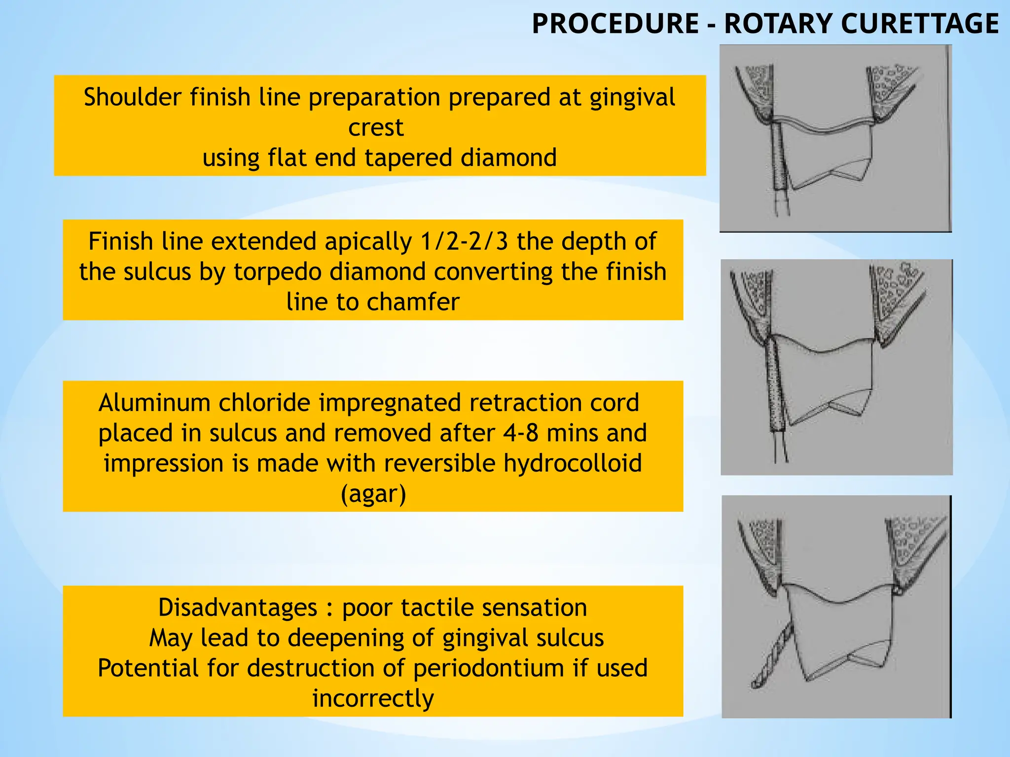 fluid control and gingival retraction in prosthodontics | PPTX