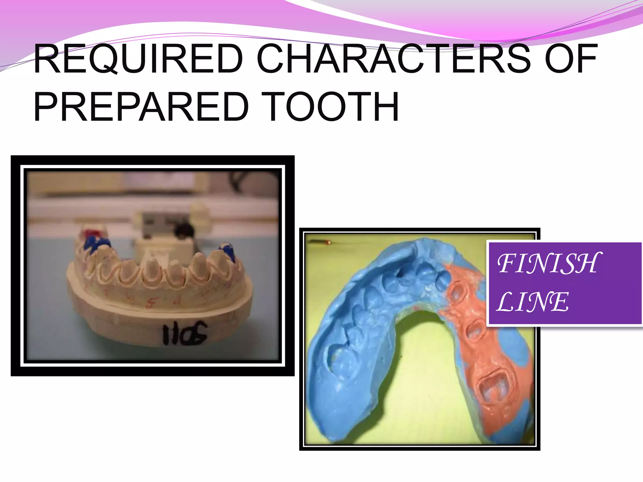 Fluid control & soft tissue management in fpd | PPTX