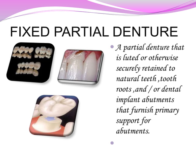 Fluid control & soft tissue management in fpd | PPTX