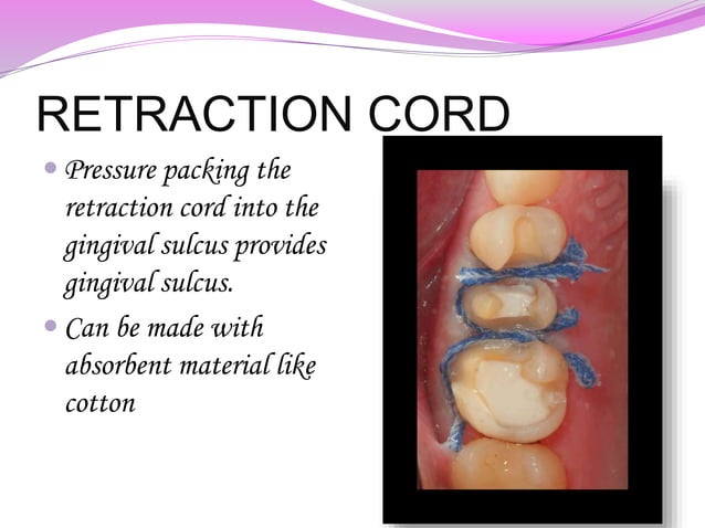 Fluid control & soft tissue management in fpd | PPTX