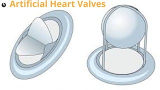 Fluid dynamics of heart valve | PPT