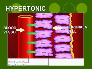 Fluid & Electrolytes Balance | PPT