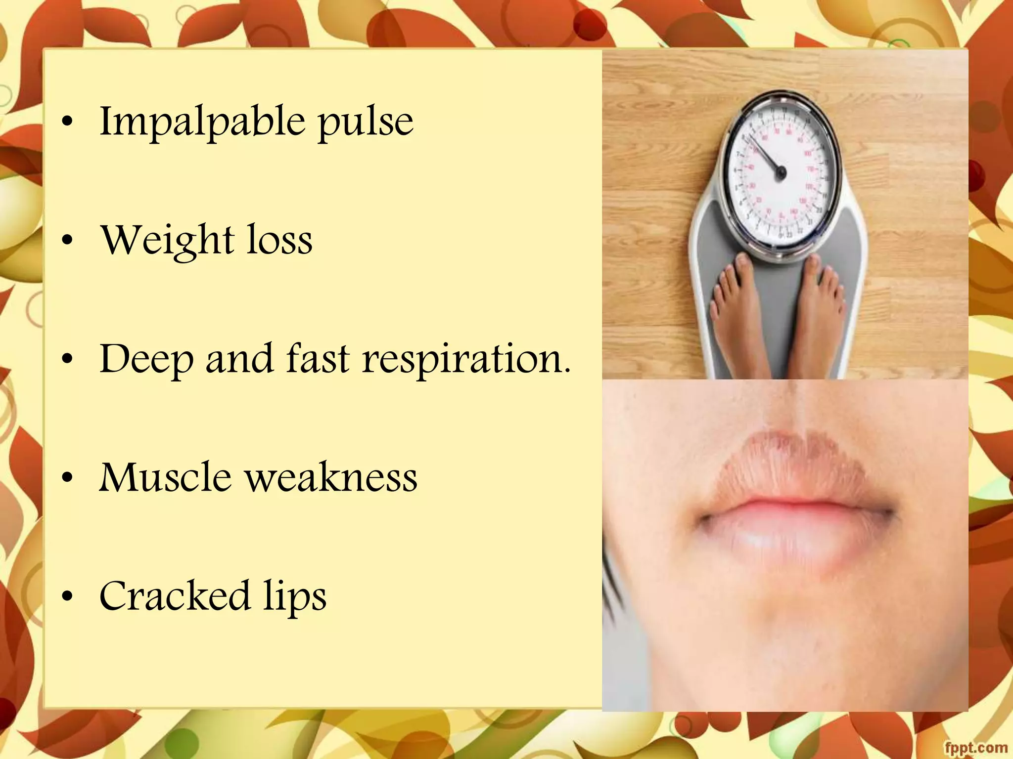 Fluid & electrolyte imbalance | PPT