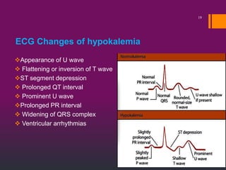 Fluid & Electrolytes - Copy.ppt