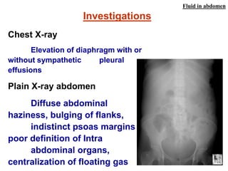 Fluid in abdomen | PPT