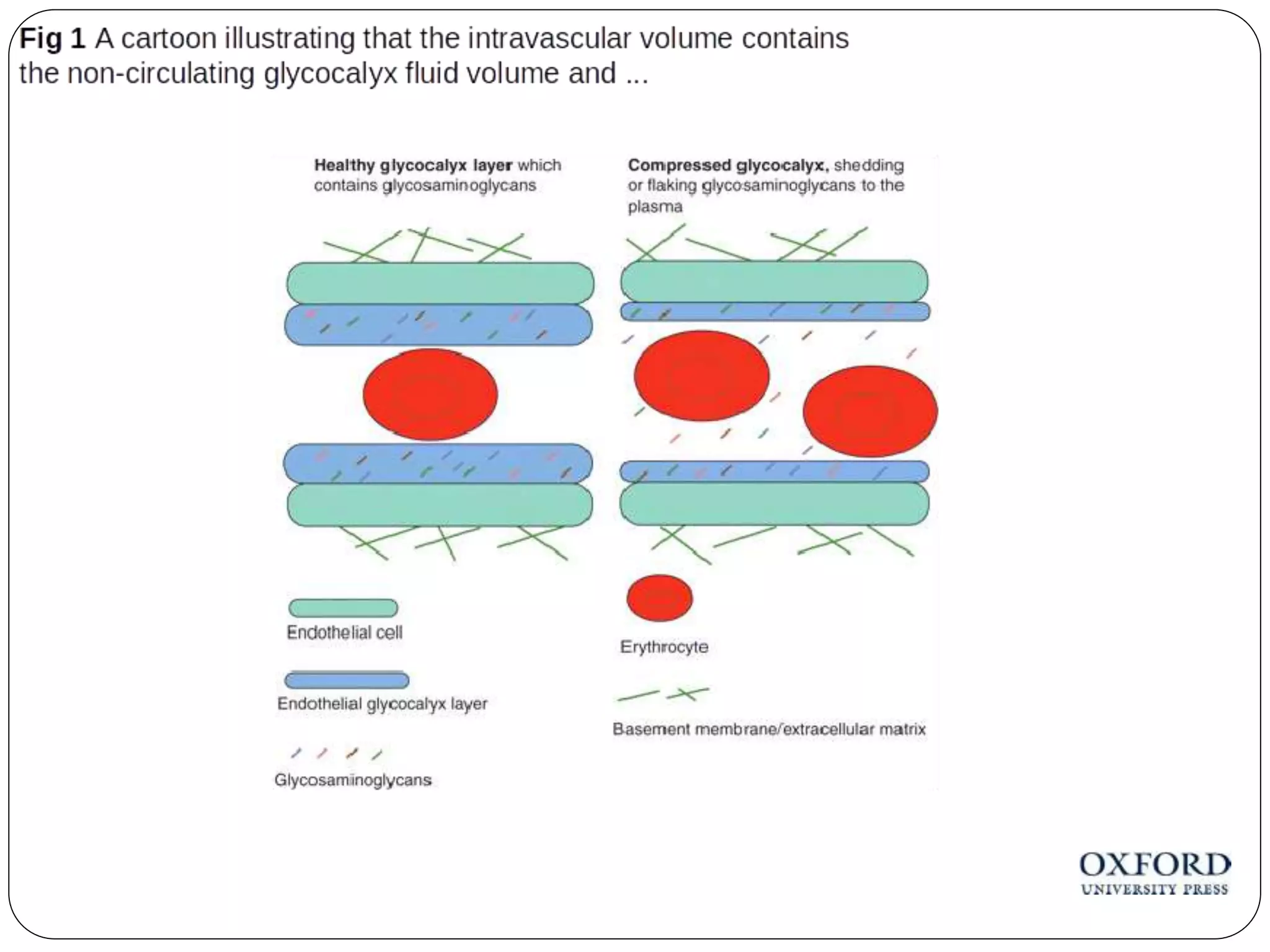 Fluid Therapy in critically ill | PPTX
