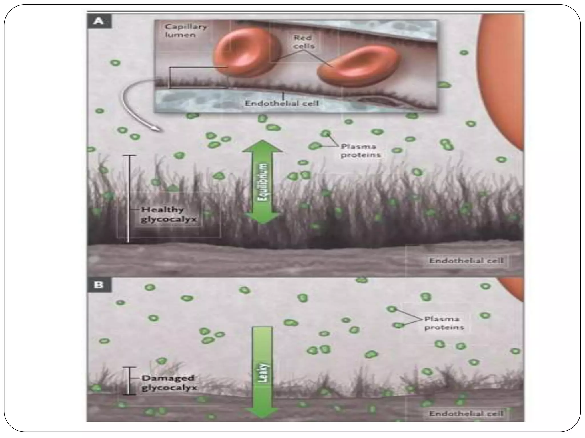 Fluid Therapy in critically ill | PPTX
