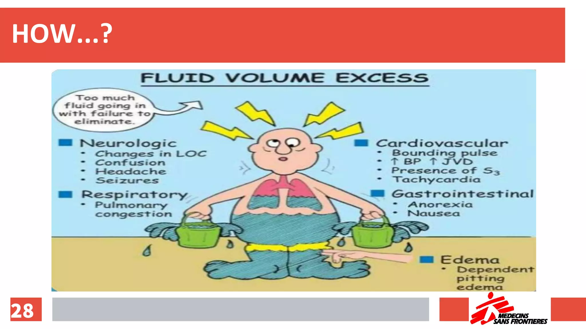 Fluid management & anesthesia | PDF
