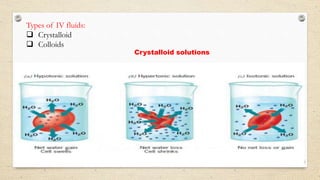 Fluid management | PPTX